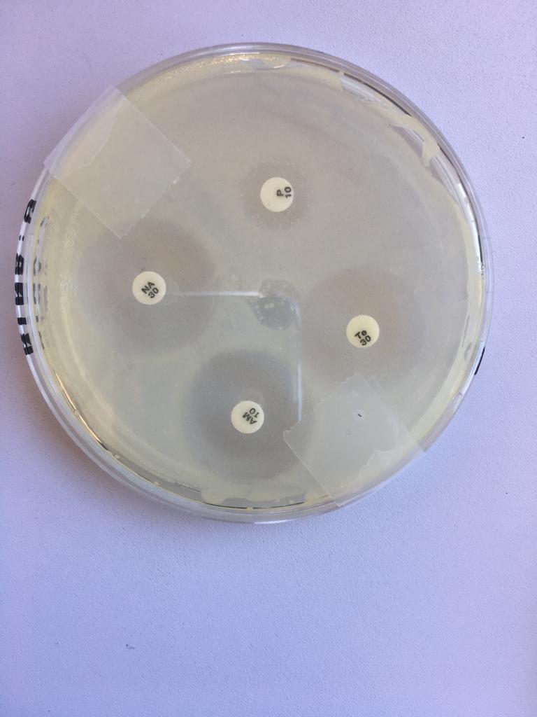 ANTIBIOGRAMME